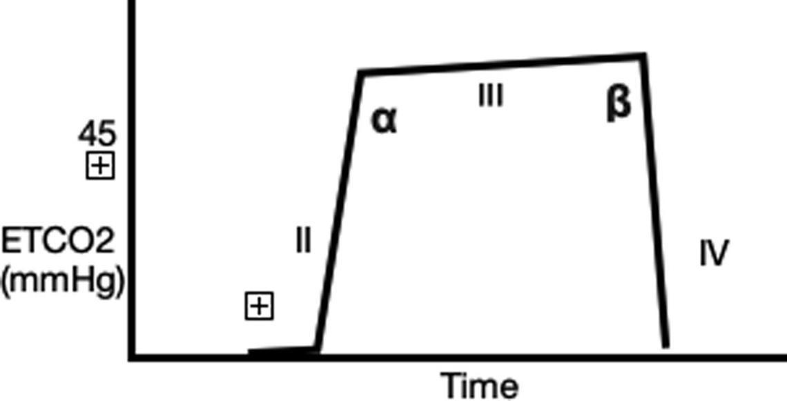 Capnography: the best anaesthetic monitoring tool? by Anarosa Wallace ...