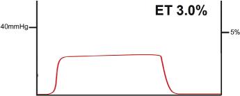 Capnography for veterinary nurses Part Three: Interpretation by Keith ...