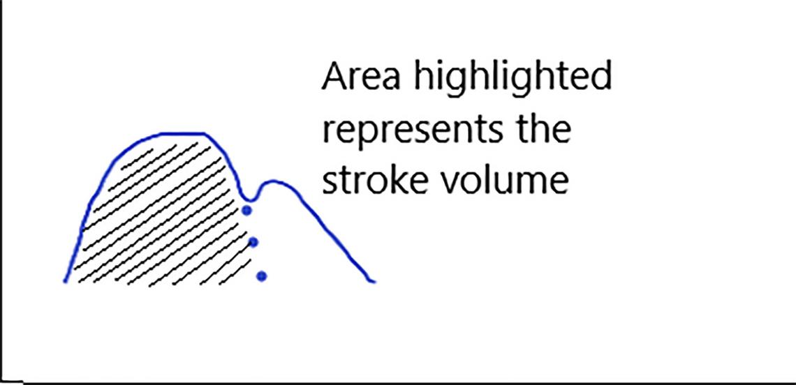 Cardiovascular changes in physiology seen in canines with gastric ...