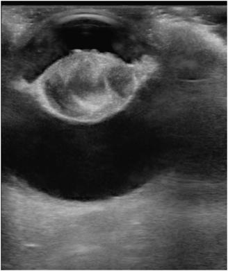 Cataract Surgery in Dogs by Sian Woodham-Davies - British Veterinary ...