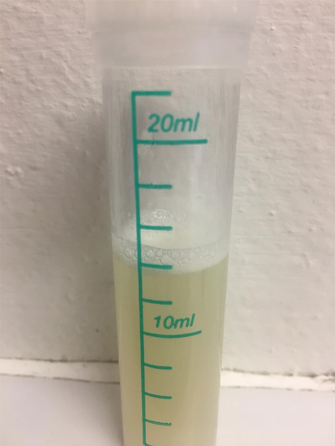 Bronchoscopy: equipment, preparation and complications by Laura George ...