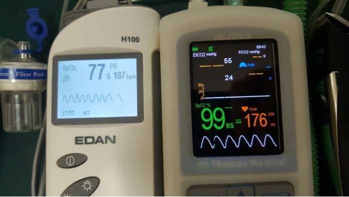 Pitfalls and common errors of anaesthetic monitoring devices. Part 1 ...
