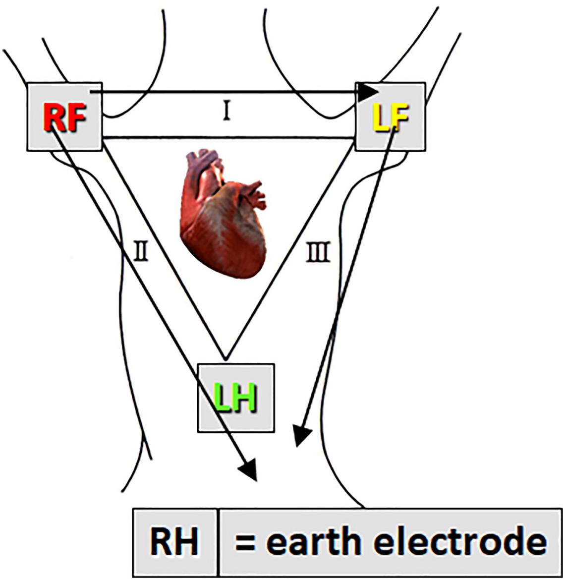 ECG interpretation by Charlotte Pace - British Veterinary Nursing ...
