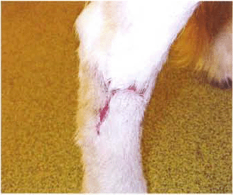 Wound management Part 2: postoperative wound breakdown by Caroline ...