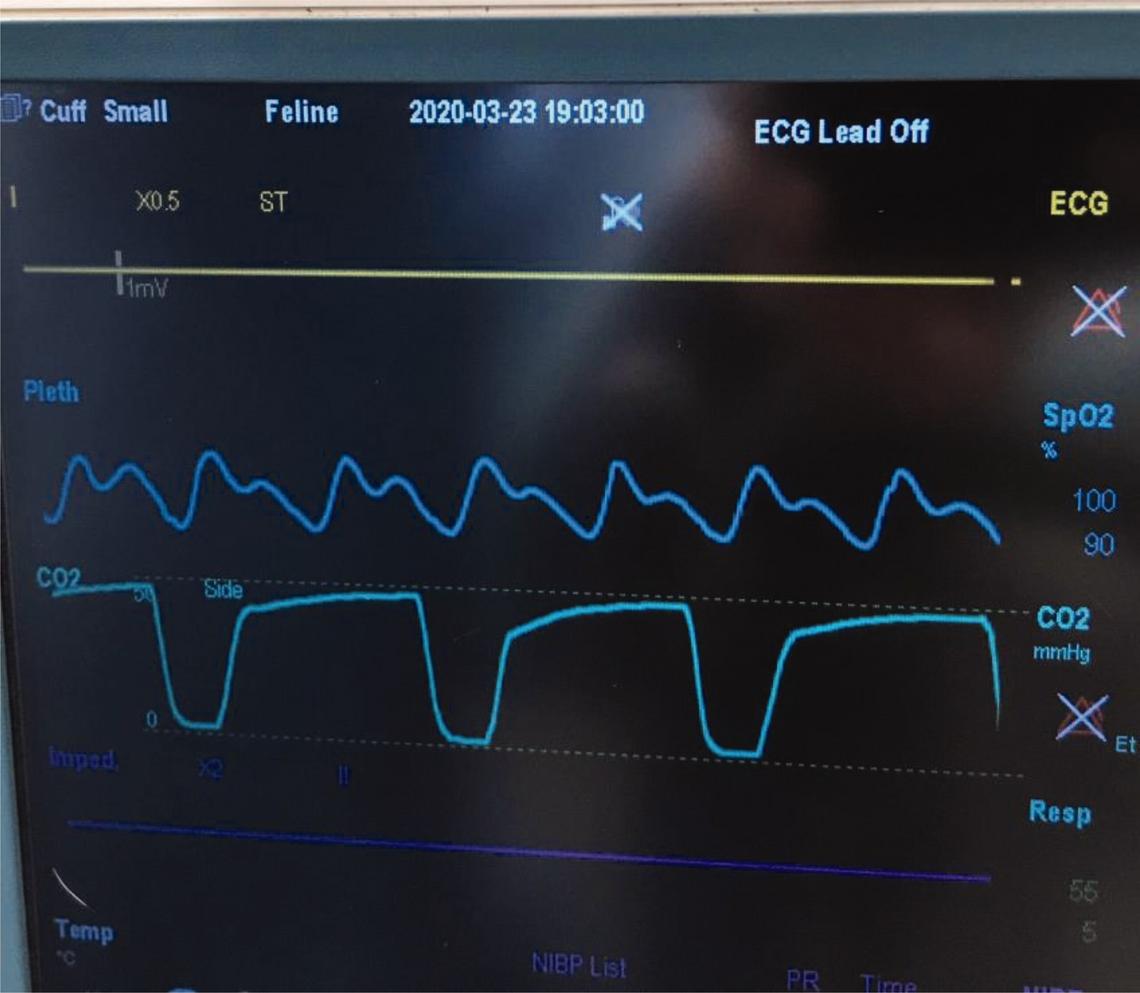 Capnography-what is it all about? by Tasmin Maclennan and Robyn McCurry ...