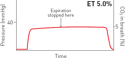 Capnography for veterinary nurses – Part 2: Capnograms and the ...