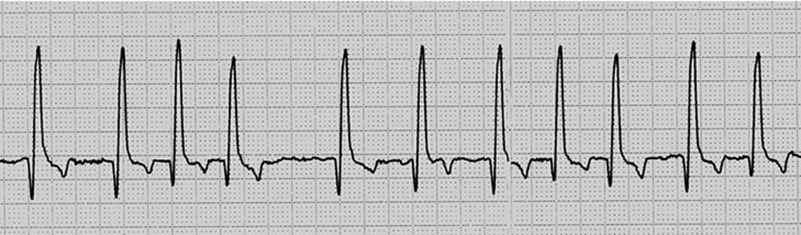 ECG interpretation by Charlotte Pace - British Veterinary Nursing ...