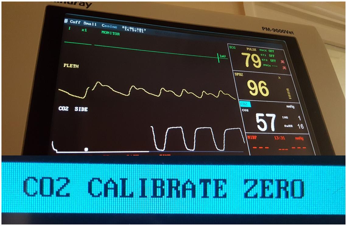 Pitfalls and common errors of anaesthetic monitoring devices part 3 ...